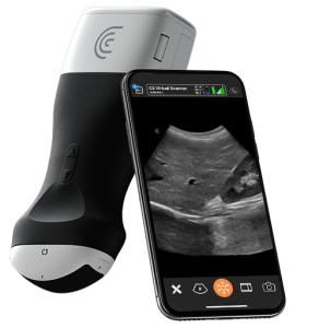 Medsol AI Solutions - Clarius Ultrasound Probes